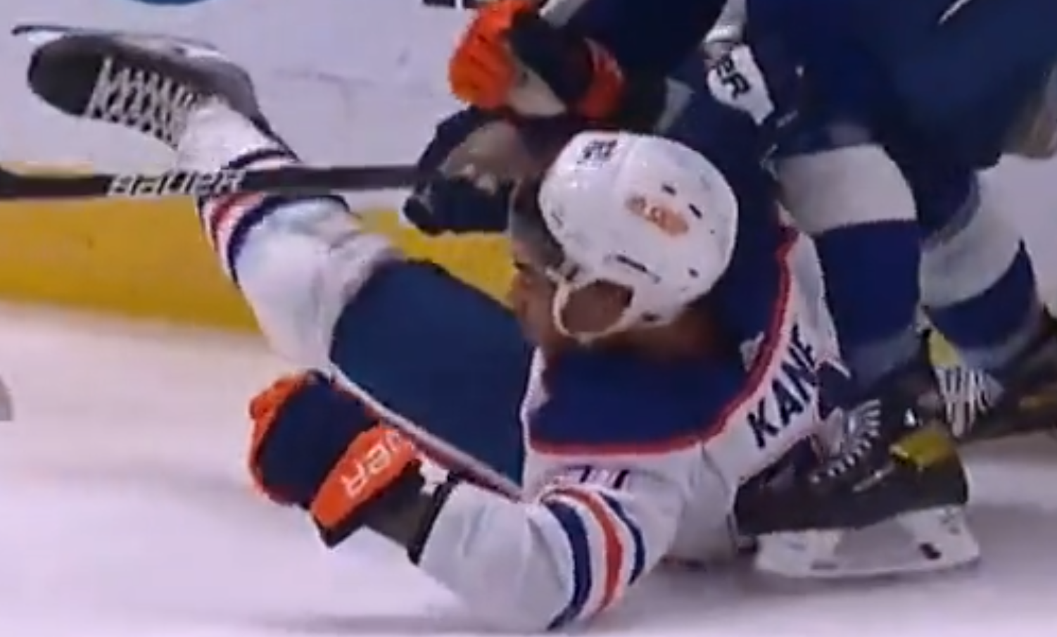 Oilers' Evander Kane Rushed To Hospital After Gruesome Injury | Newsbusters